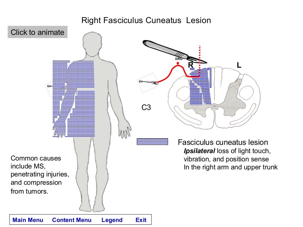 Spinal Cord Lesions Module