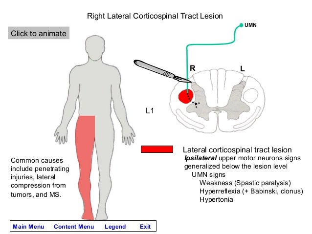 Spinal cord lesions module