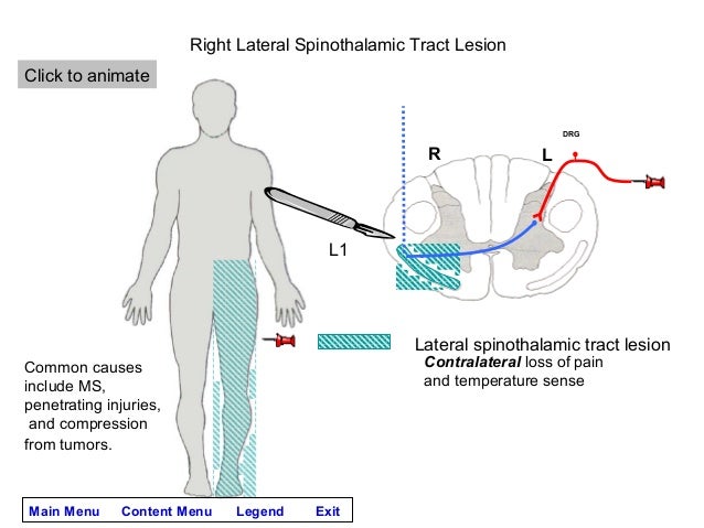 Spinal cord lesions module