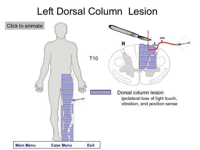 Spinal cord lesions module