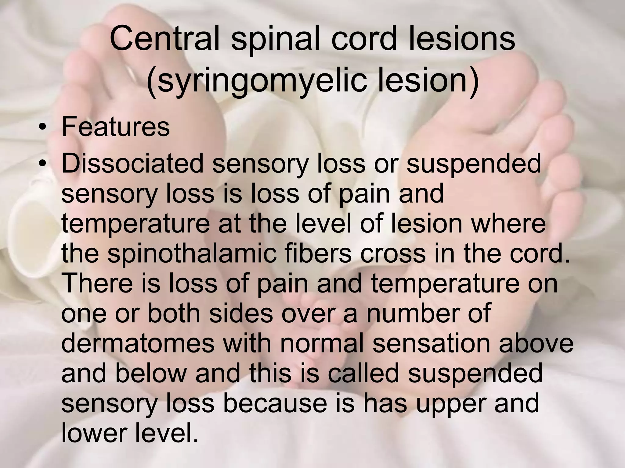 Spinal cord lession localisation | PPTX