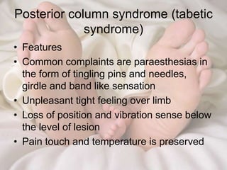 Spinal cord lession localisation | PPTX