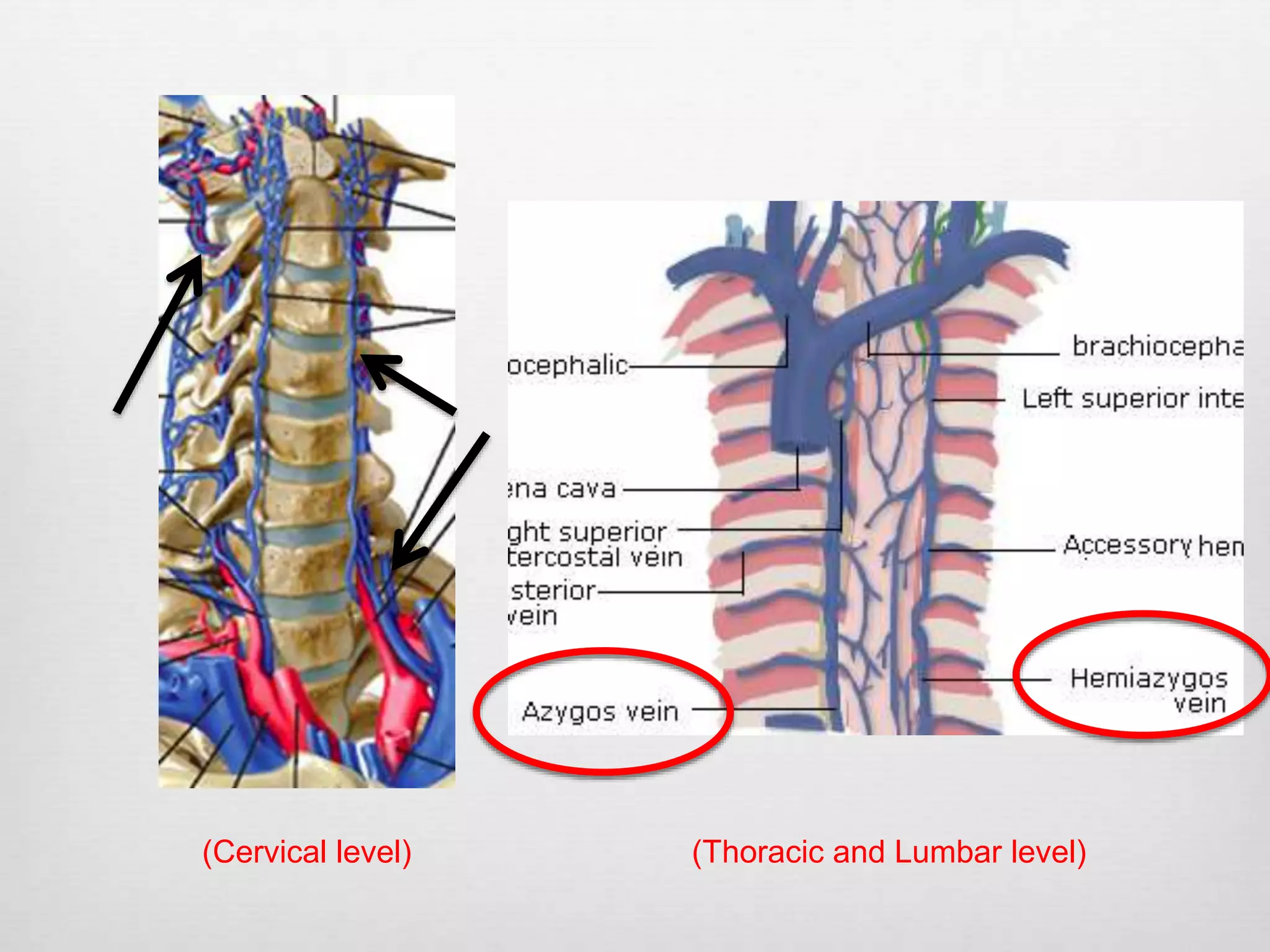 Spinal Cord Magnetic Resonance Angiography - Spinal MRA | PPTX
