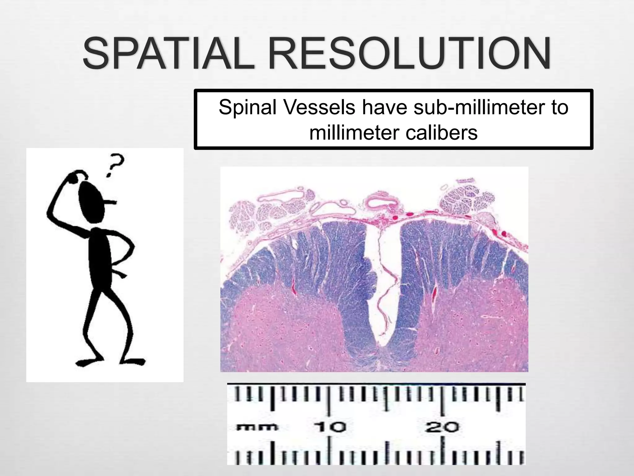 Spinal Cord Magnetic Resonance Angiography - Spinal MRA | PPTX