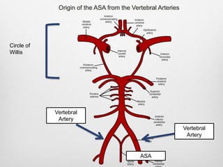 Spinal Cord Magnetic Resonance Angiography - Spinal MRA | PPTX
