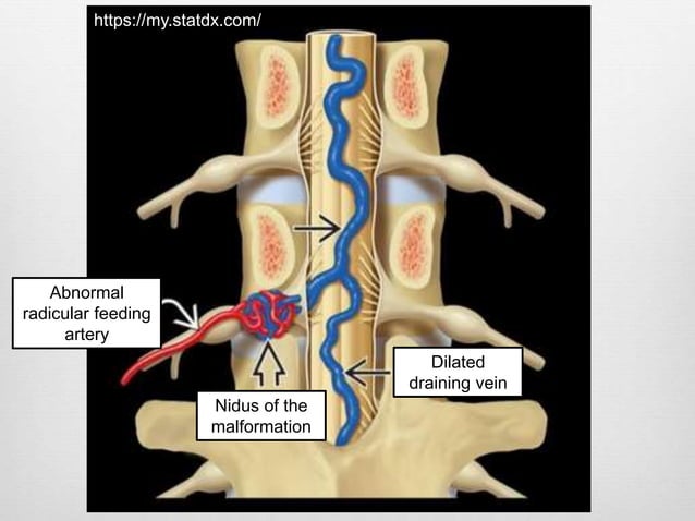 Spinal Cord Magnetic Resonance Angiography - Spinal MRA | PPTX