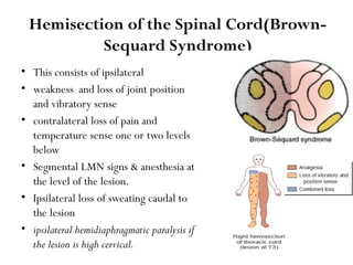 Spinal cord injury2 ,disease and other chronic lower extremity ...