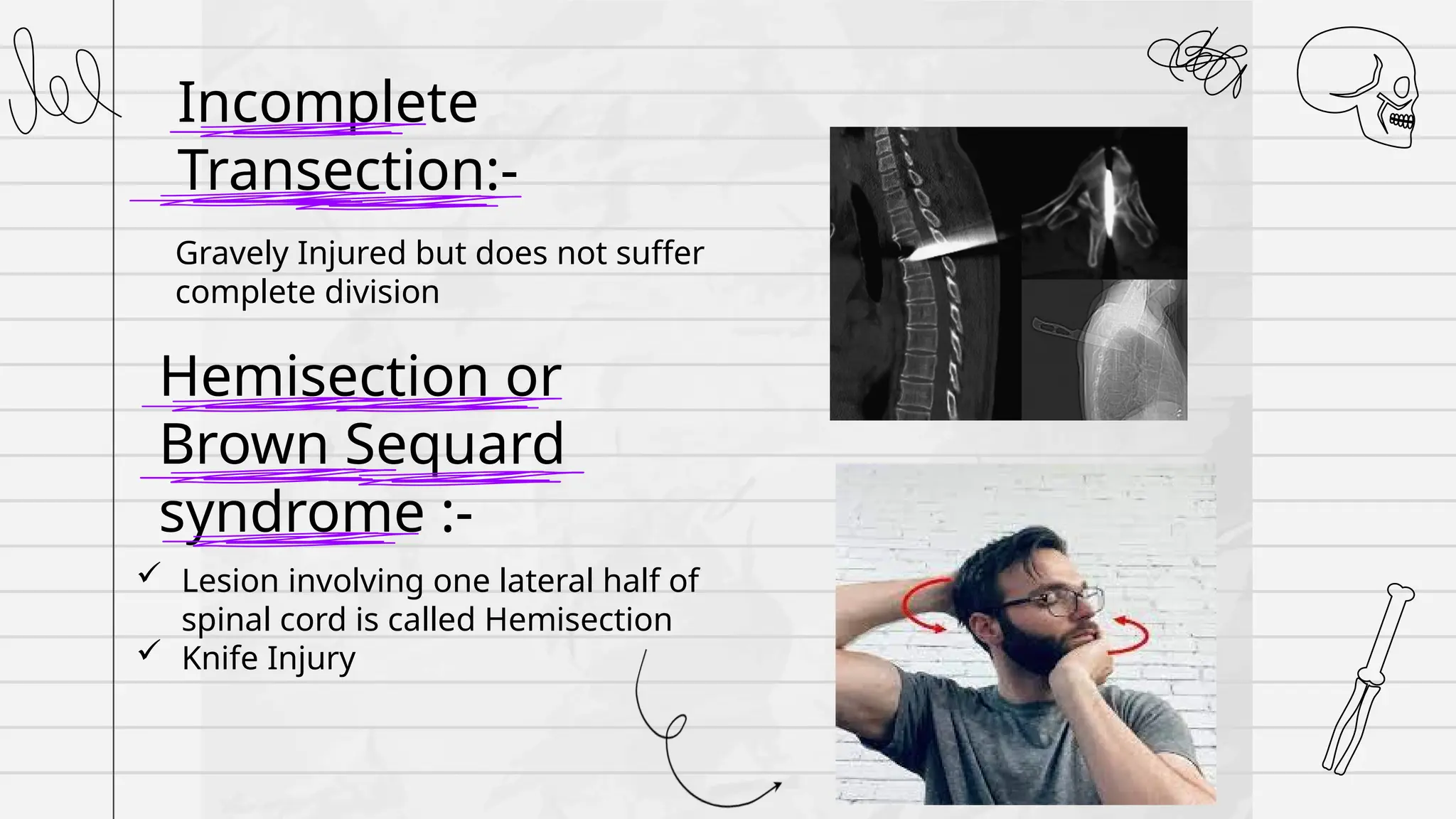 spinal cord anatomy and spinal cord physiology | PPTX