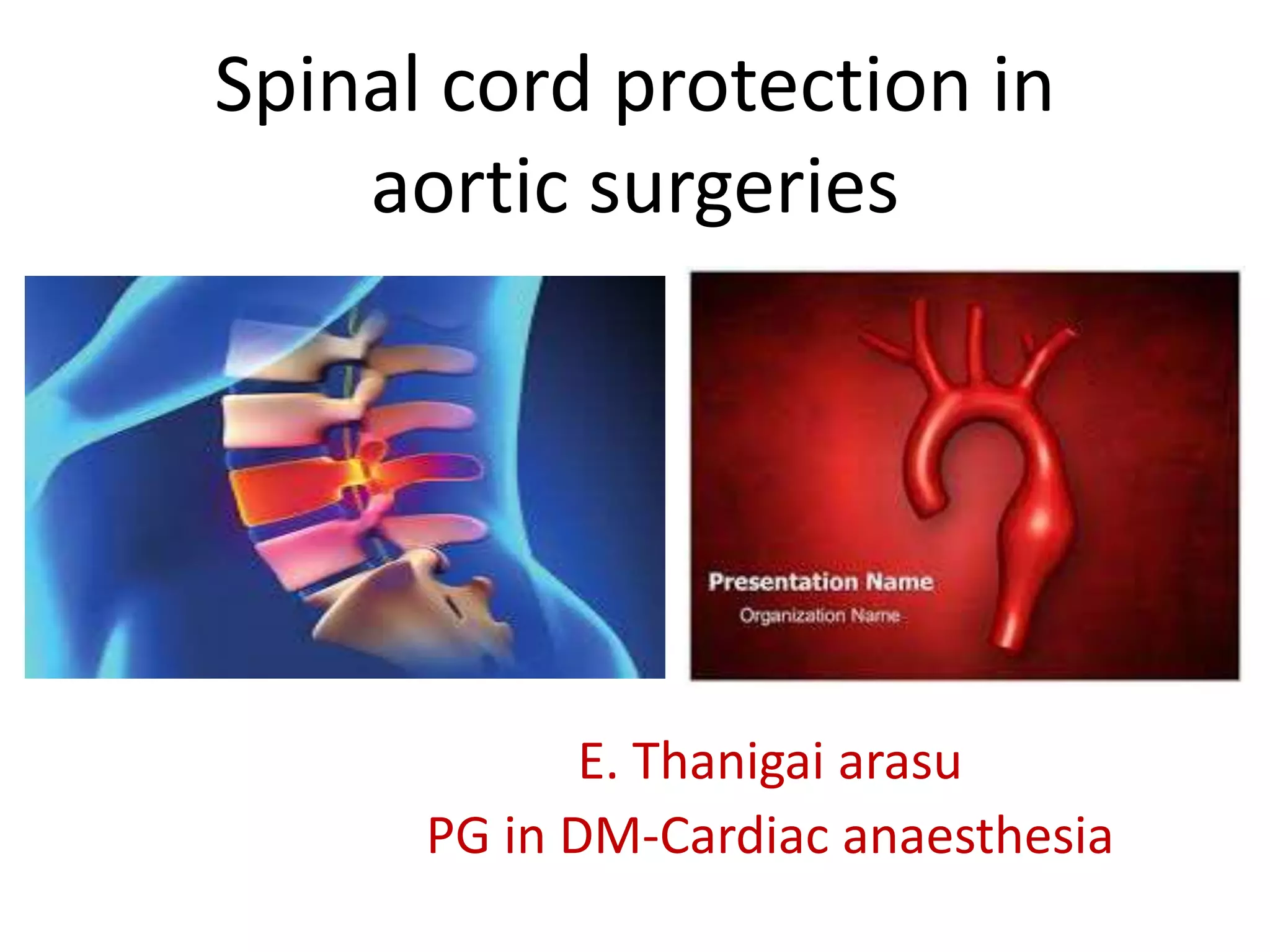 Spinal cord protection in aortic surgeries | PPTX