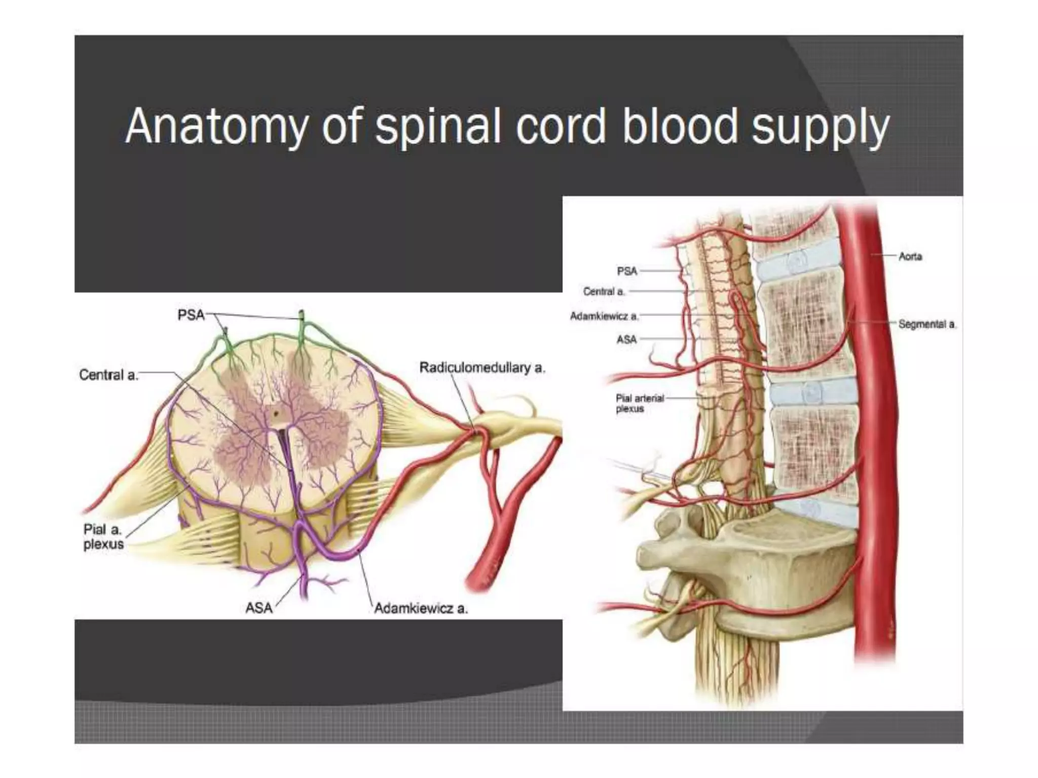 Spinal cord protection in aortic surgeries | PPTX