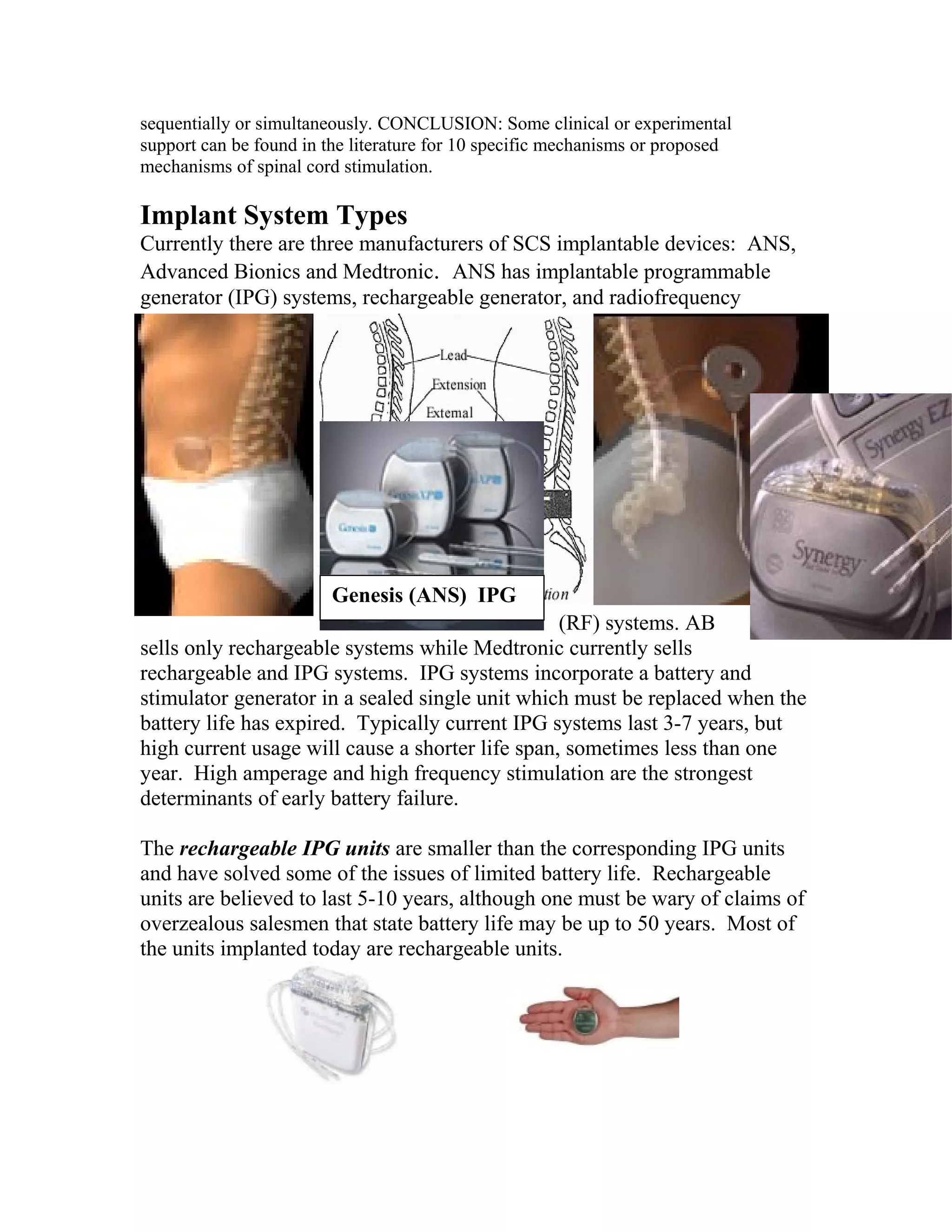 Spinal Cord Stimulation Primer | DOC
