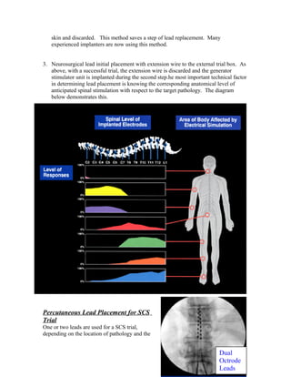 Spinal Cord Stimulation Primer | DOC