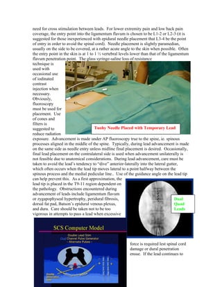 Spinal Cord Stimulation Primer | DOC