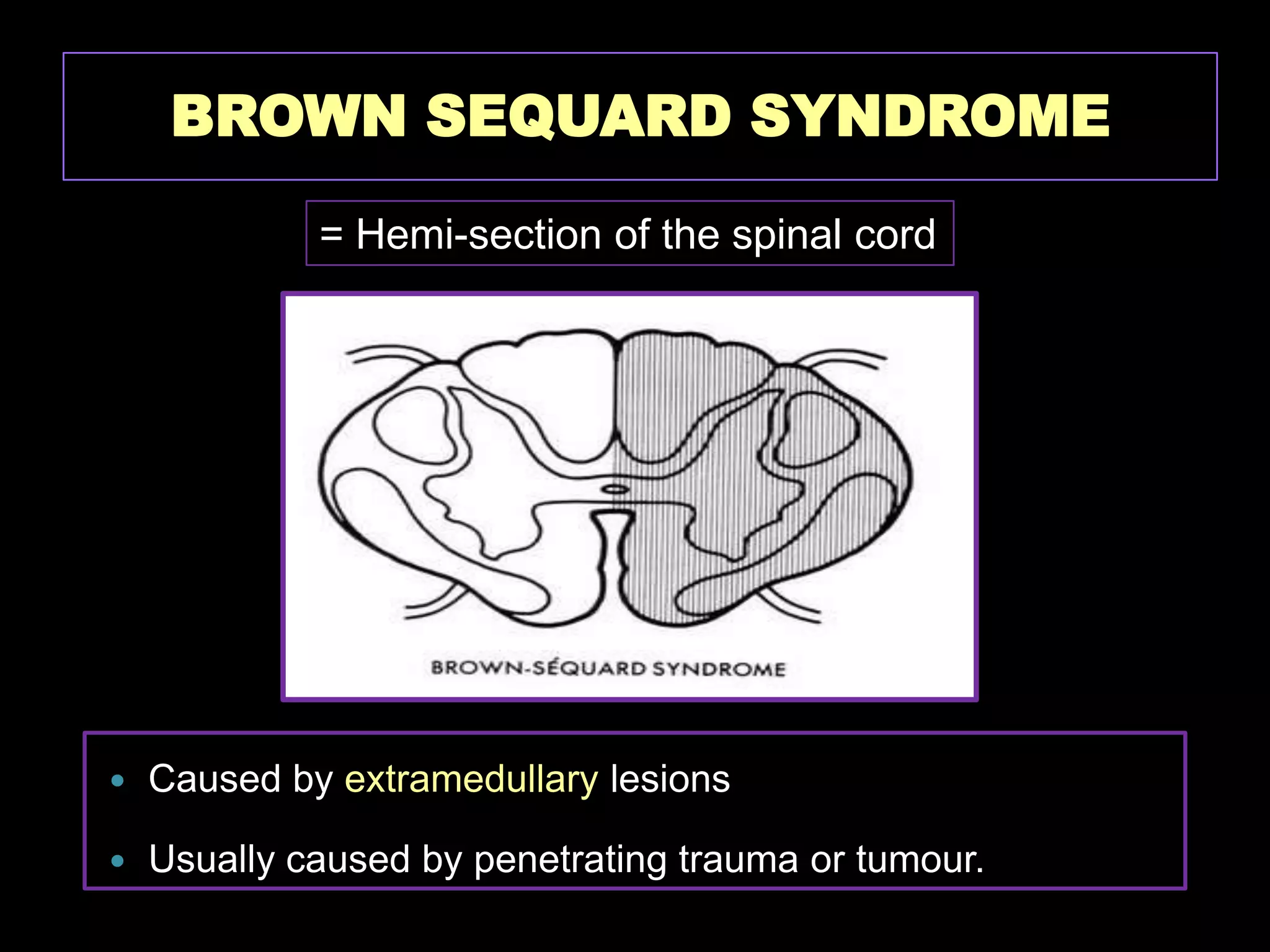 Spinal cord syndromes | PPSX
