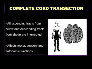 Spinal cord syndromes | PPSX