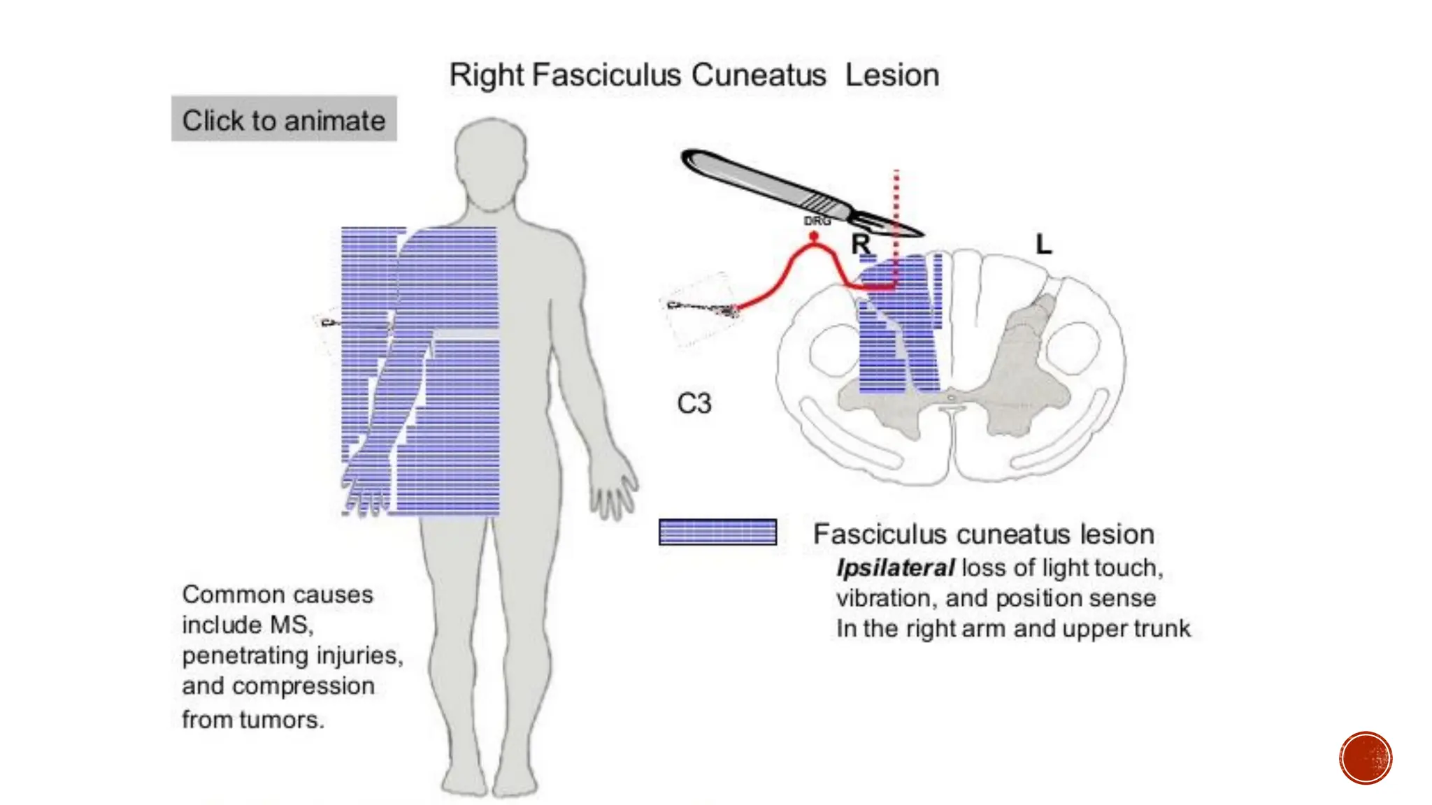 SPINAL CORD TRACTS for students and health care workers | PDF