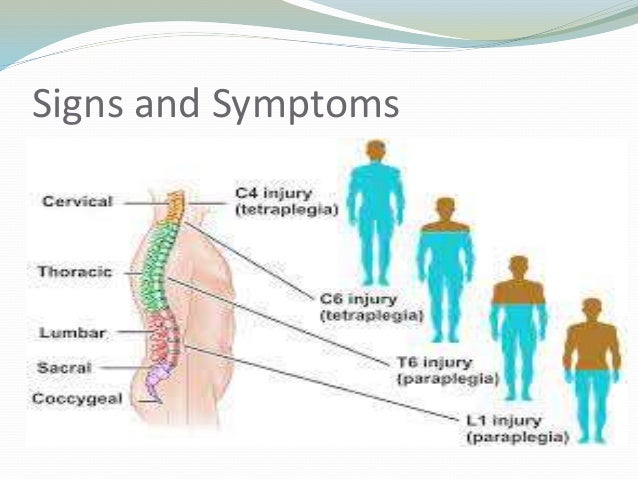 Spinal cord treatment | PPT