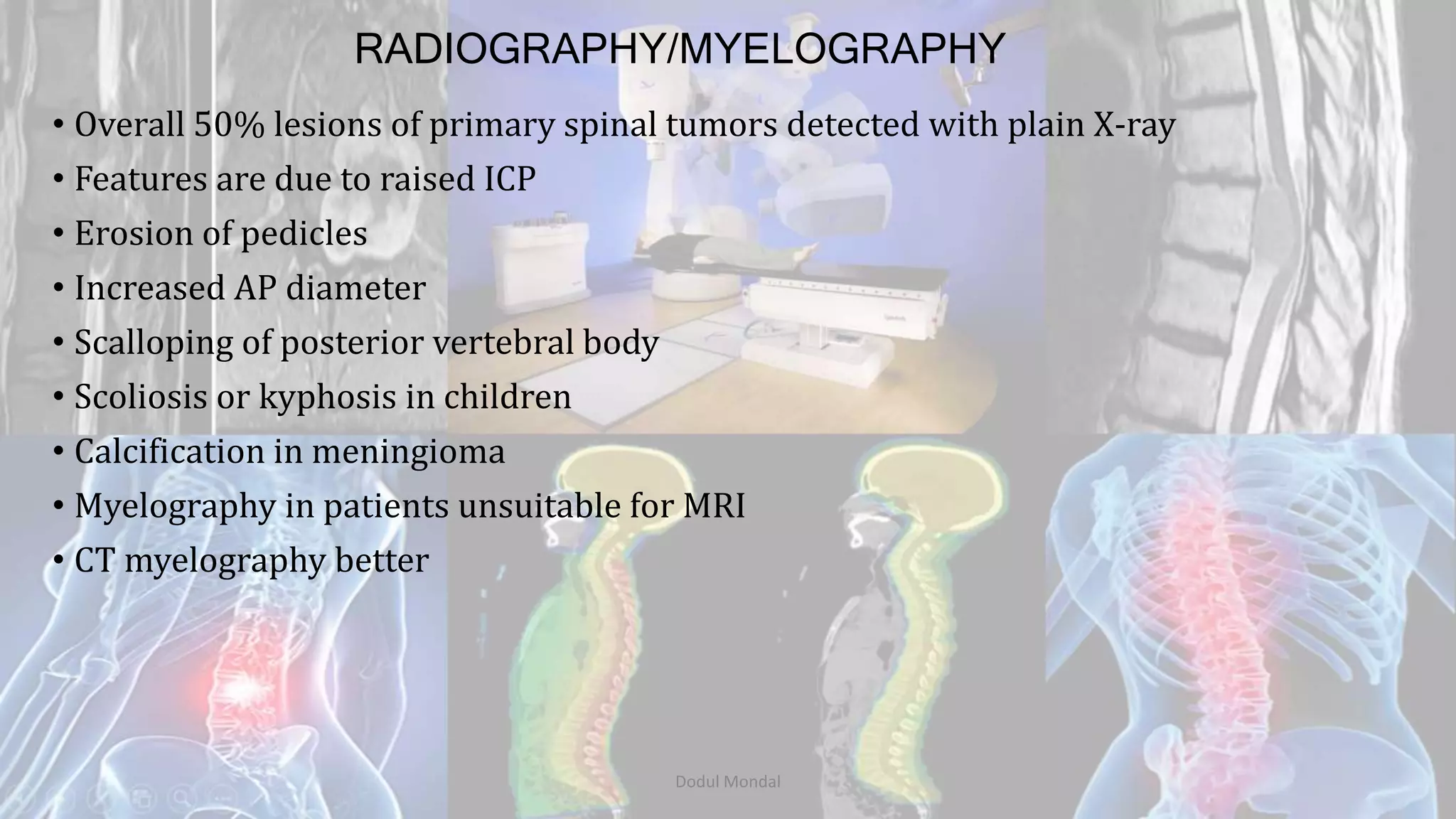 Spinal cord tumor | PPTX