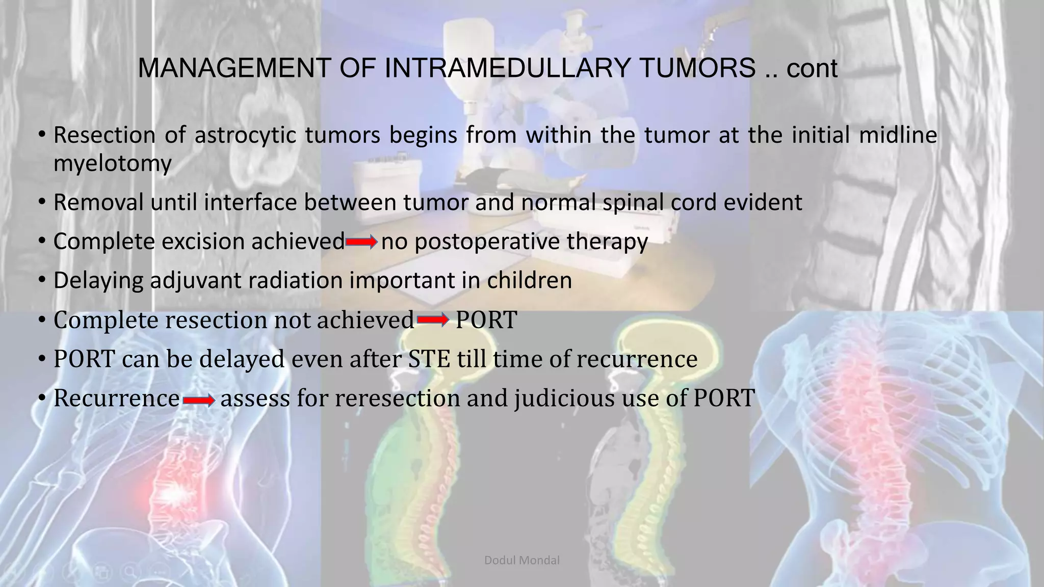 Spinal cord tumor | PPTX