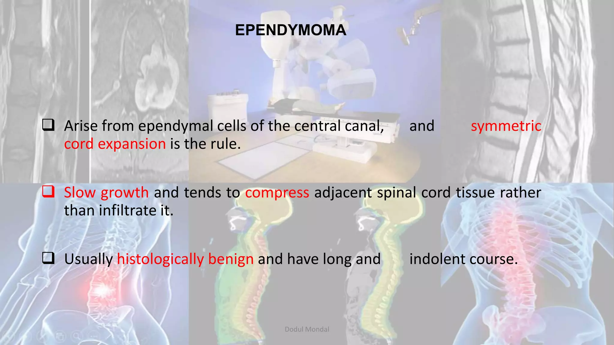 Spinal cord tumor | PPTX
