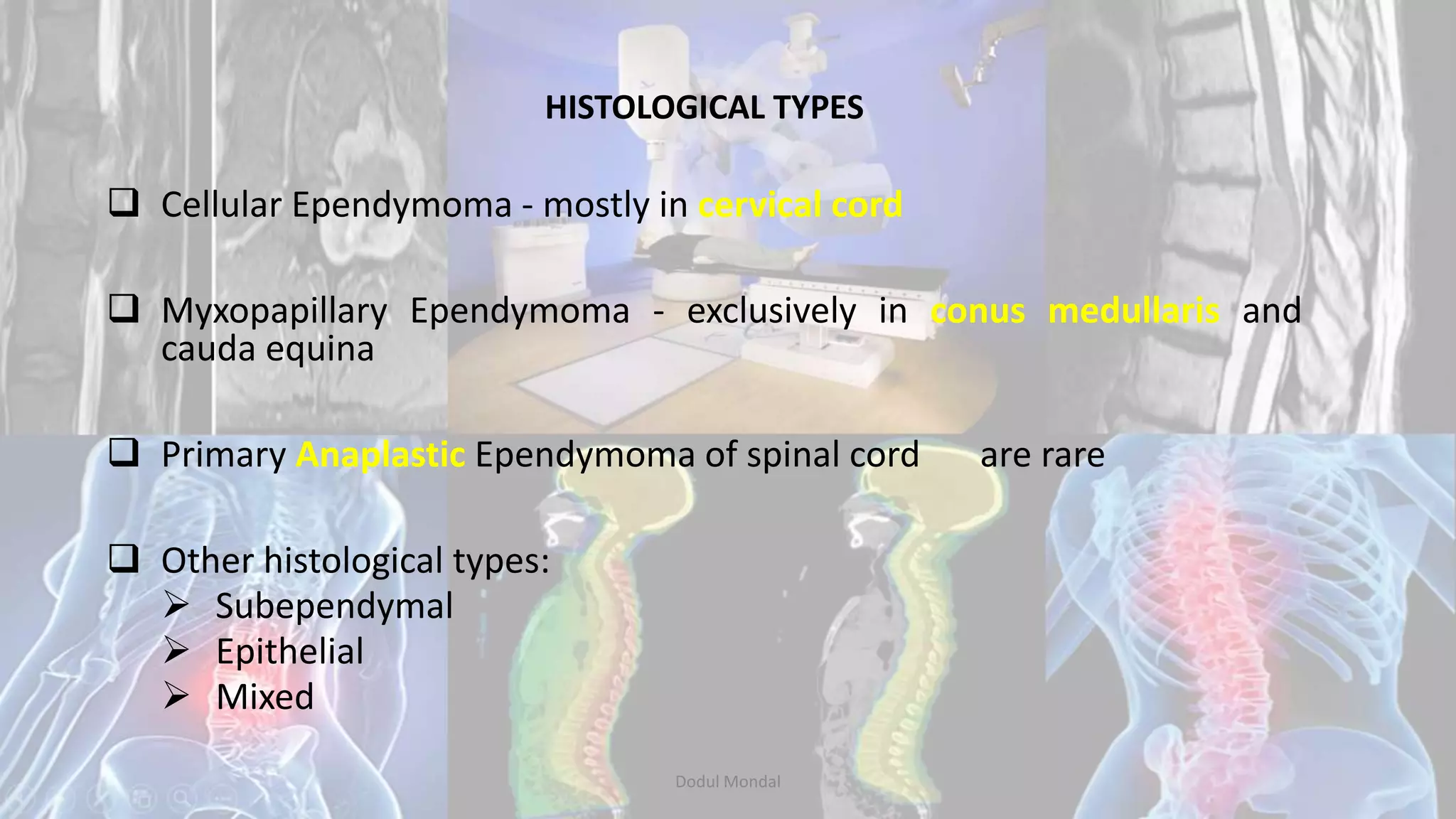 Spinal cord tumor | PPTX