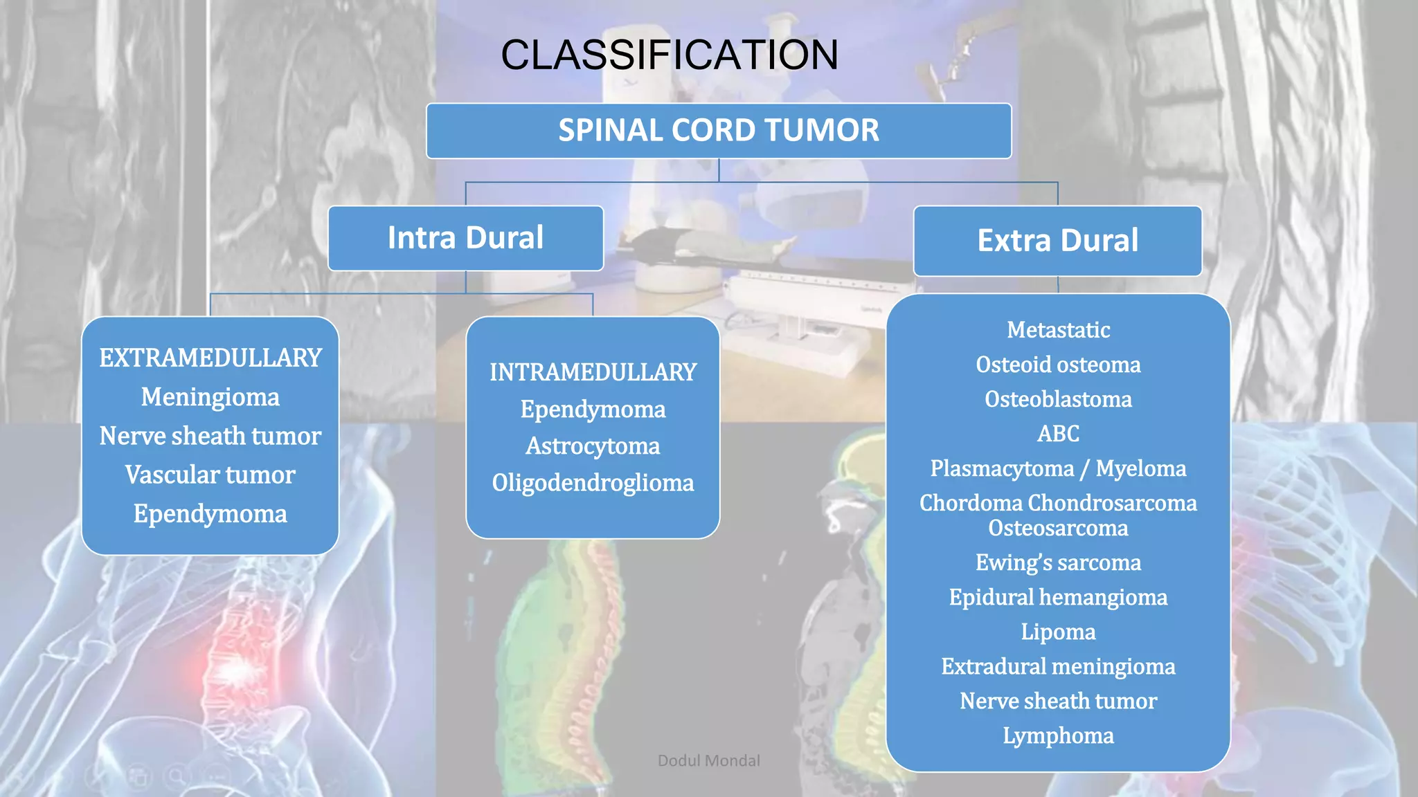 Spinal cord tumor | PPTX