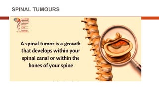 Spinal cord tumors | PPTX