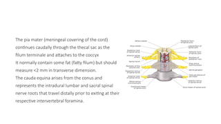 SPINAL CORD TUMORS MRI AND CT FEATURES.pptx