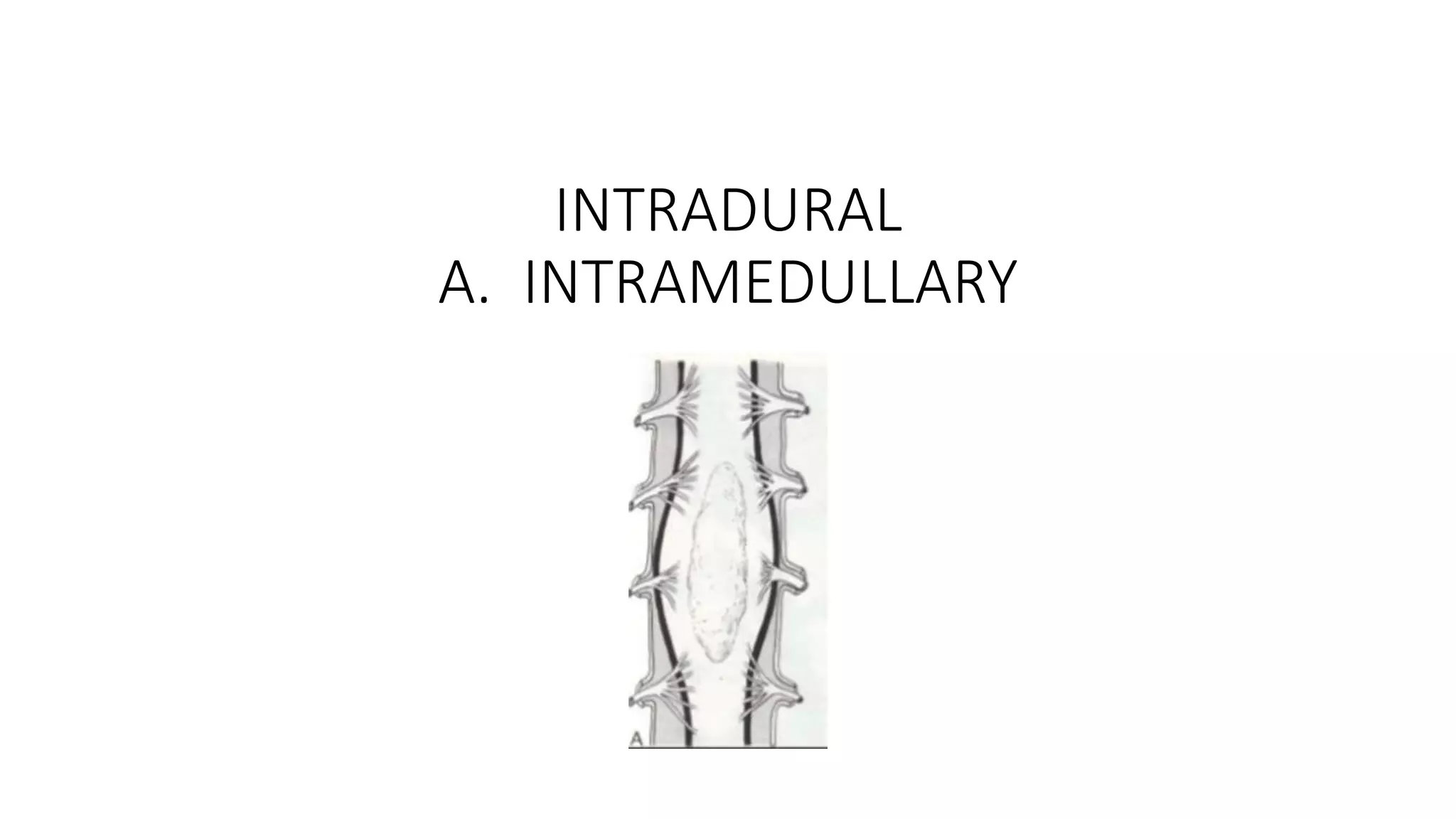 SPINAL CORD TUMOUR.pptx