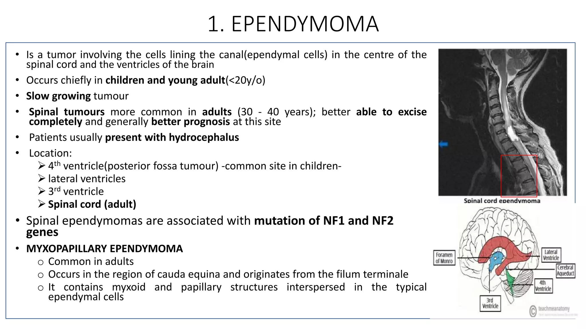 SPINAL CORD TUMOUR.pptx