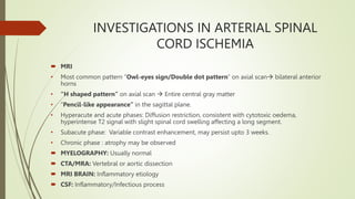 Spinal cord vascular syndrome.pptx
