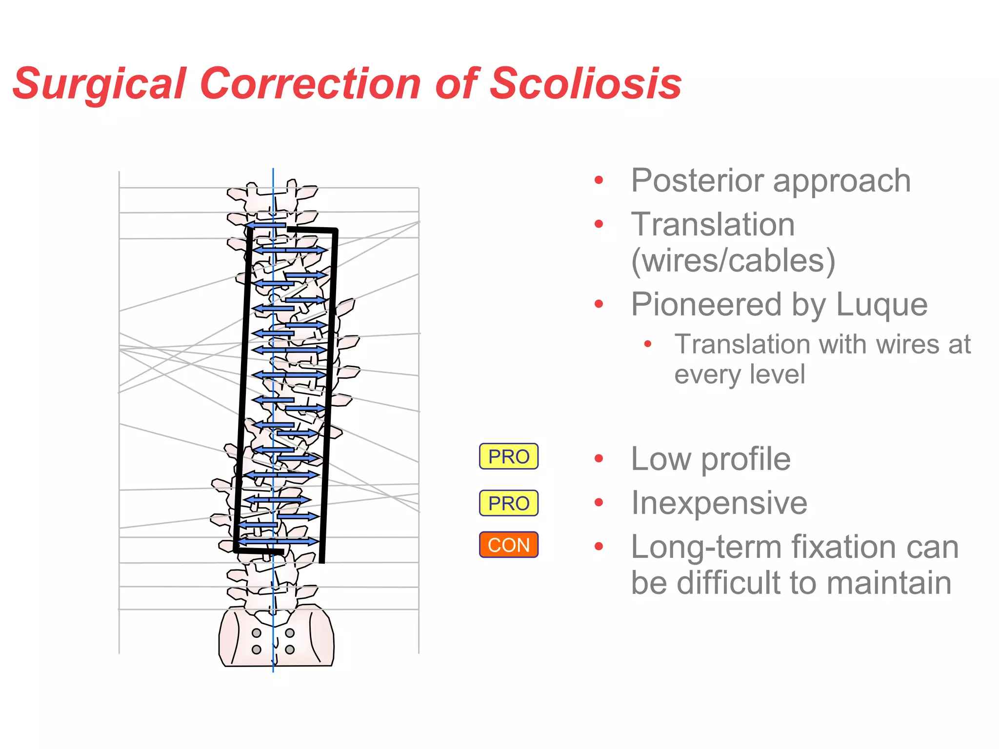 Scoliosis Lecture by Professor Dr. Md. Shah Alam | PDF