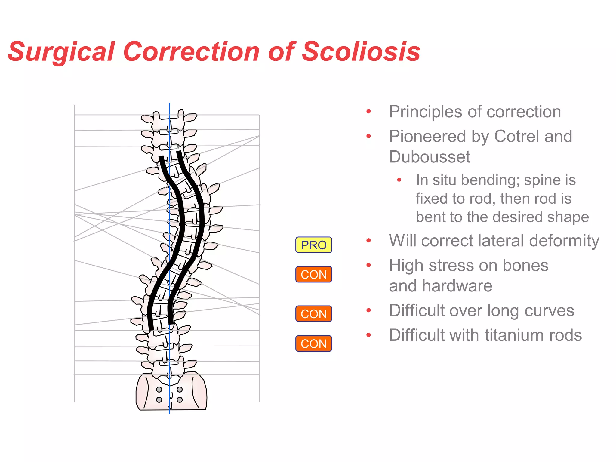 Scoliosis Lecture by Professor Dr. Md. Shah Alam | PDF