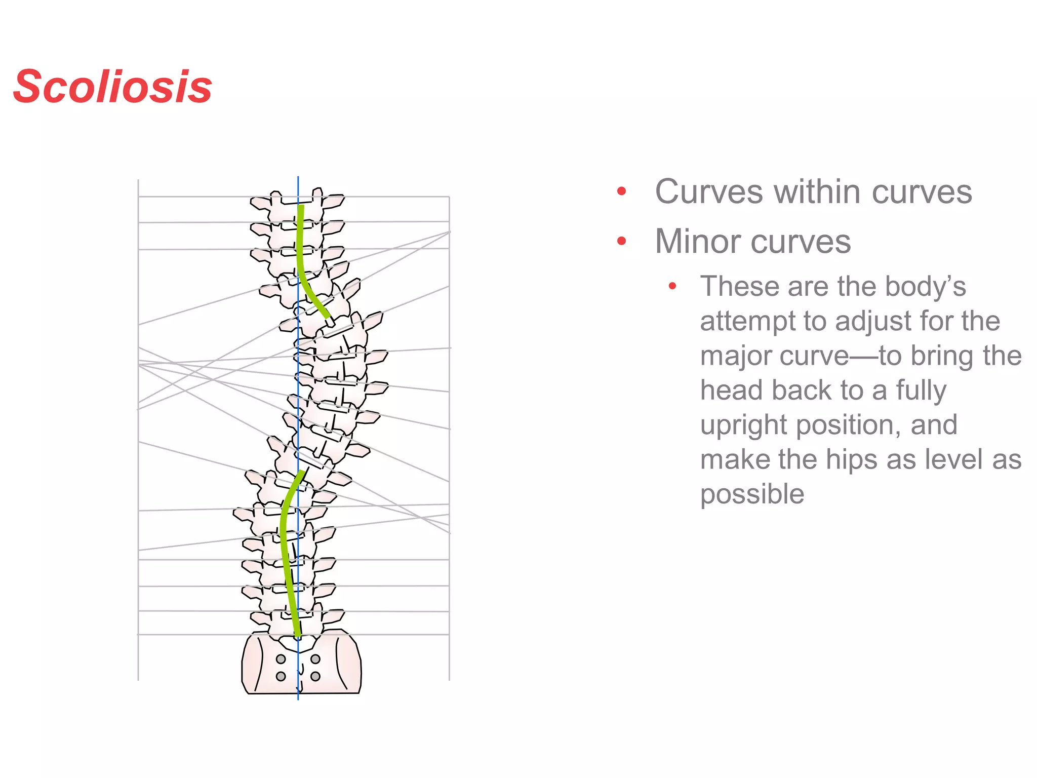 Scoliosis Lecture by Professor Dr. Md. Shah Alam | PDF