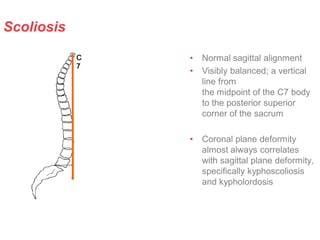 Kypholordosis