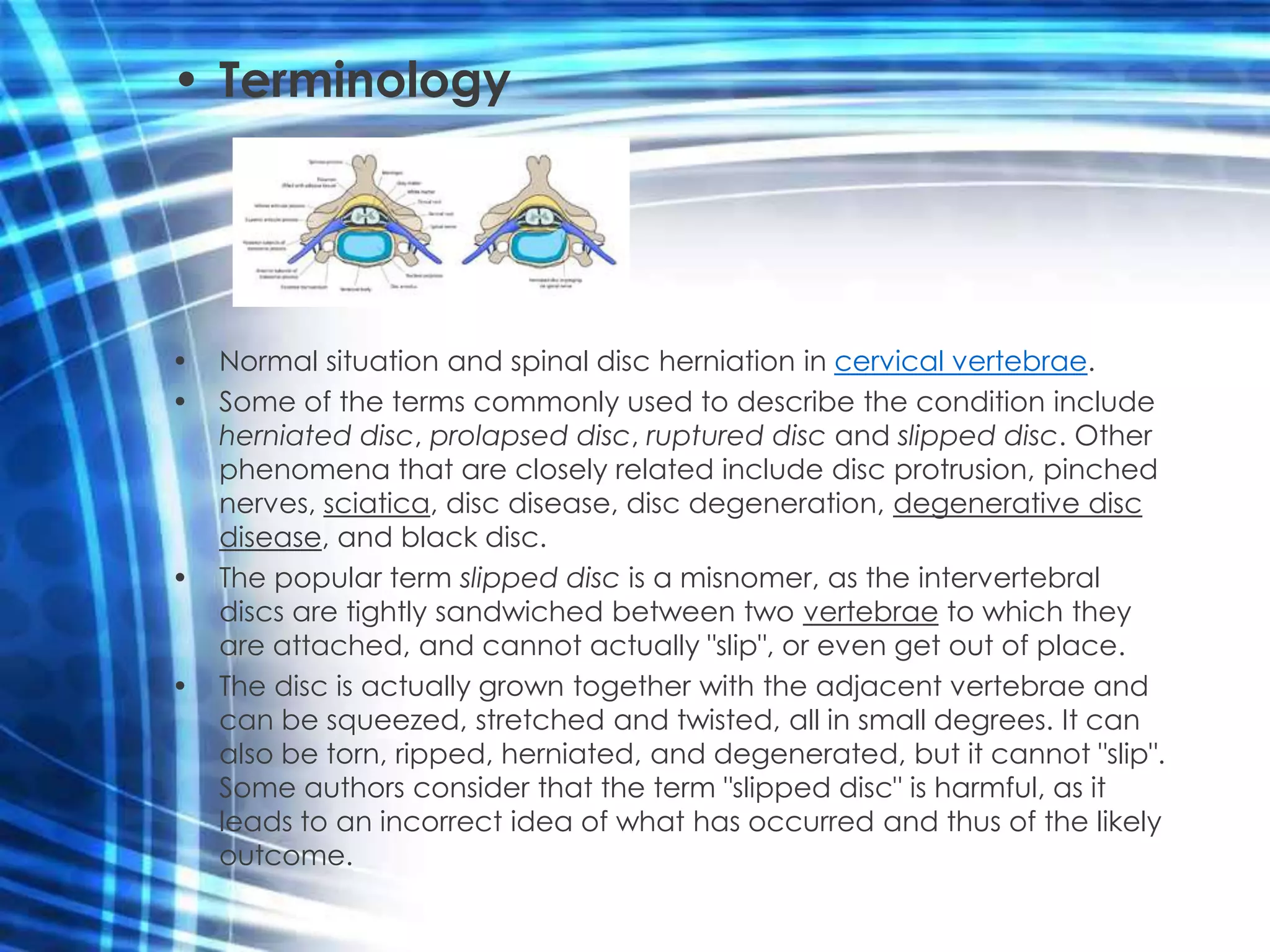 Spinal disc herniation | PPTX