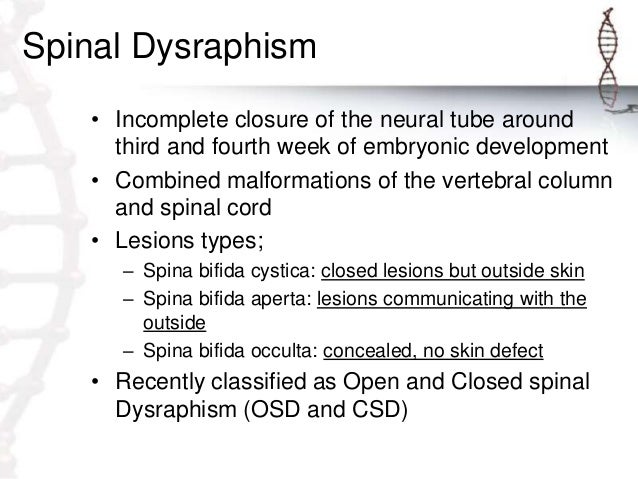 Spinal dysraphism and its management