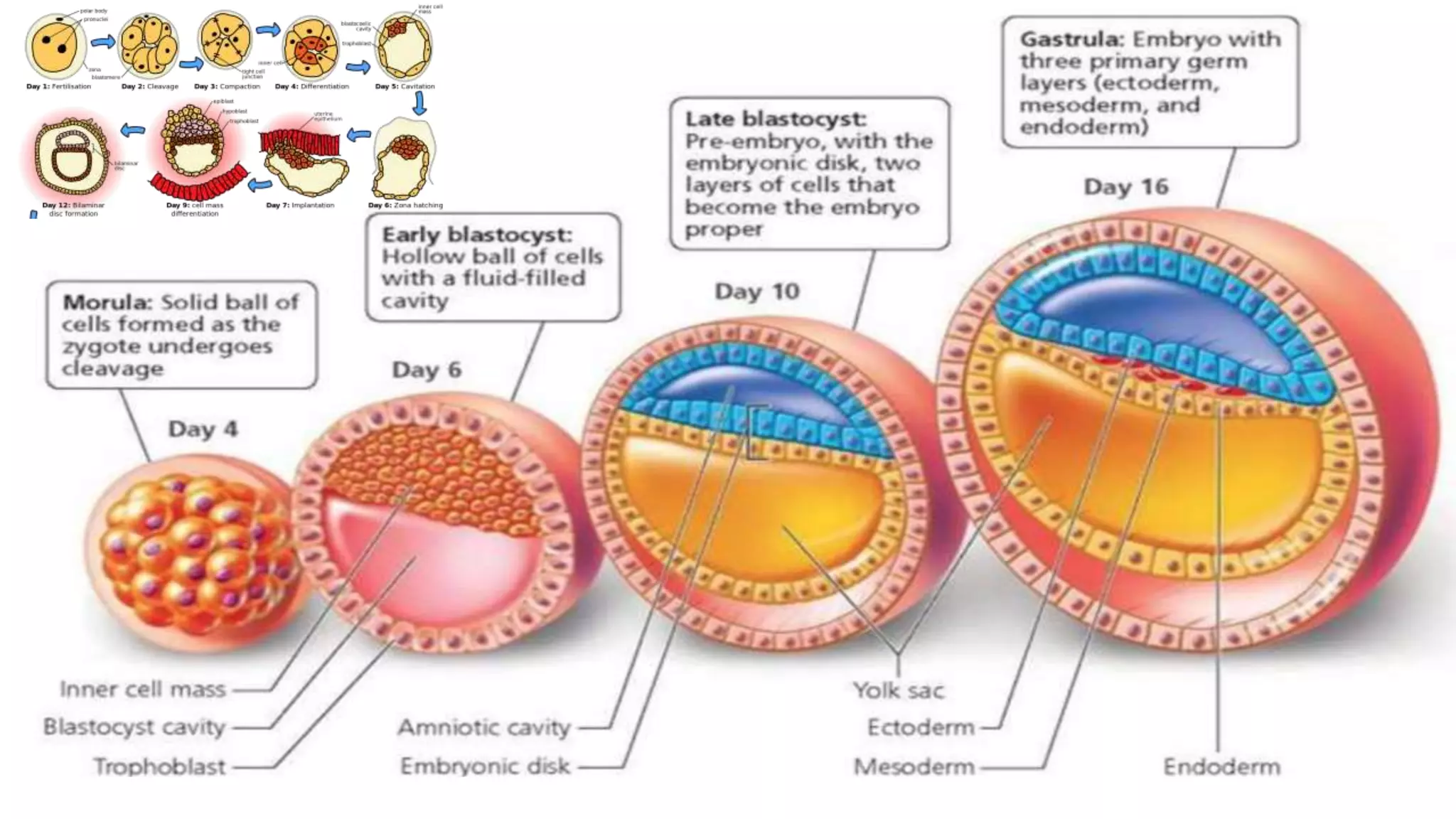 Spinal dysraphism | PPTX