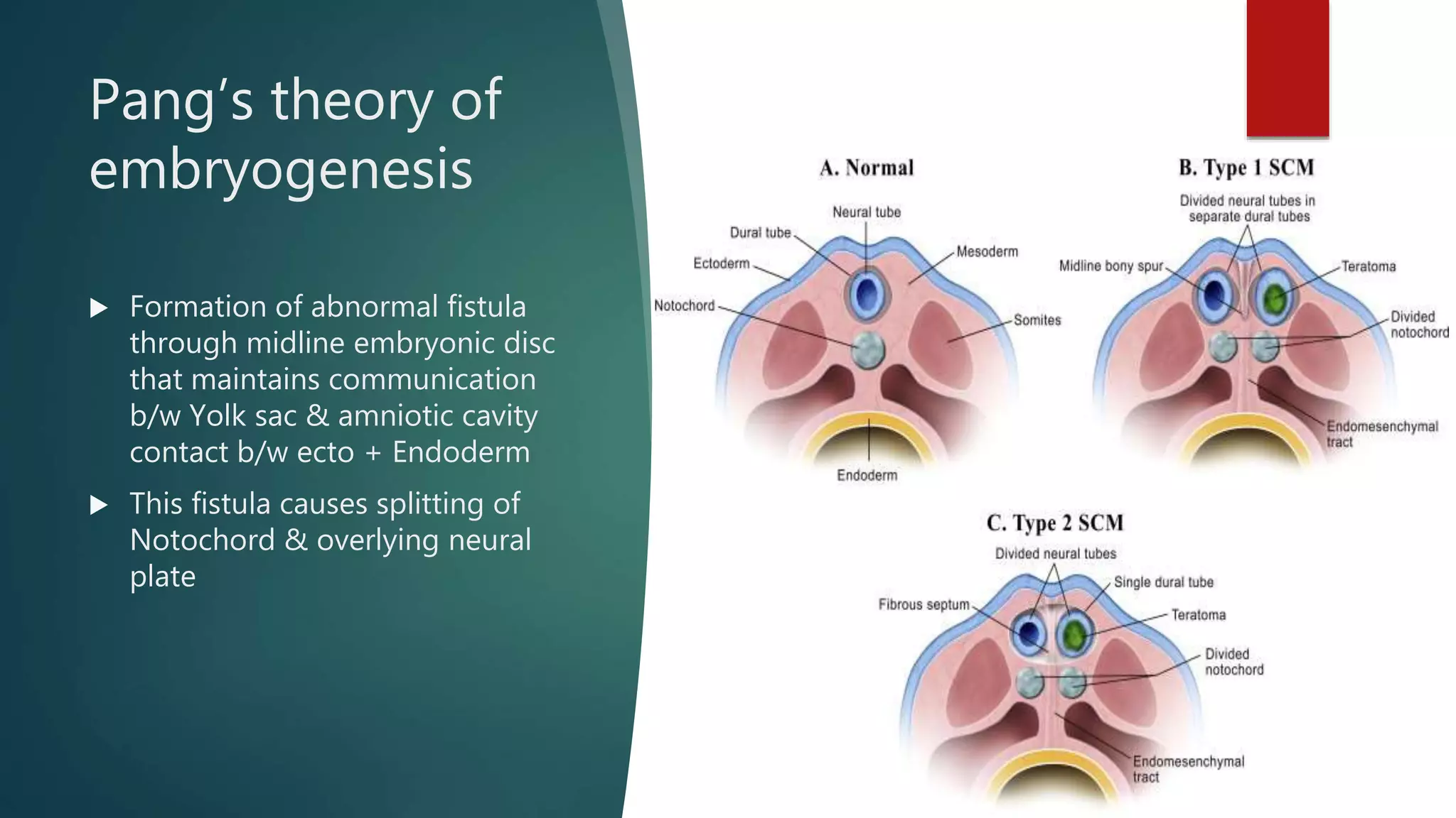 Spinal dysraphism | PPTX