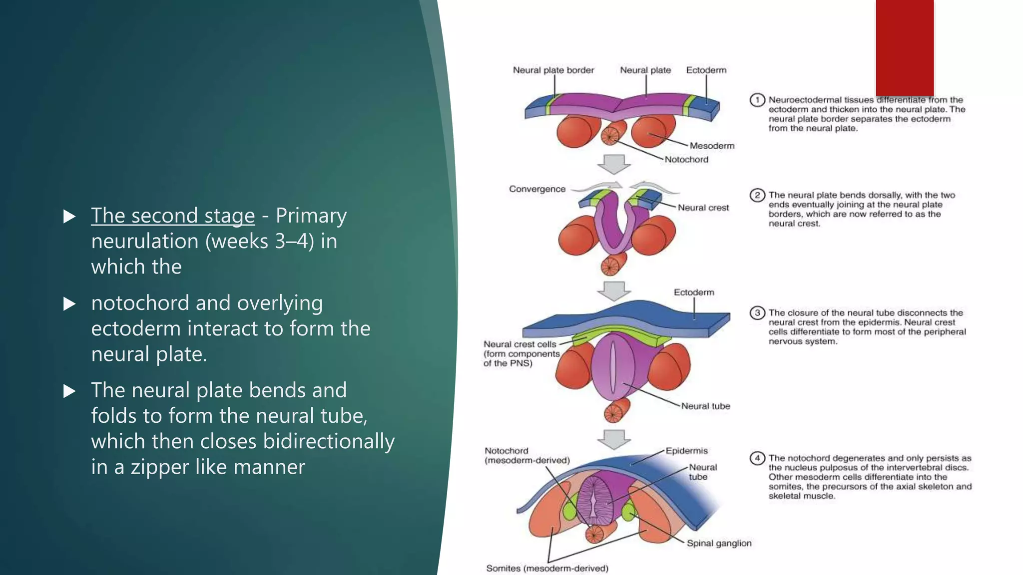 Spinal dysraphism | PPTX