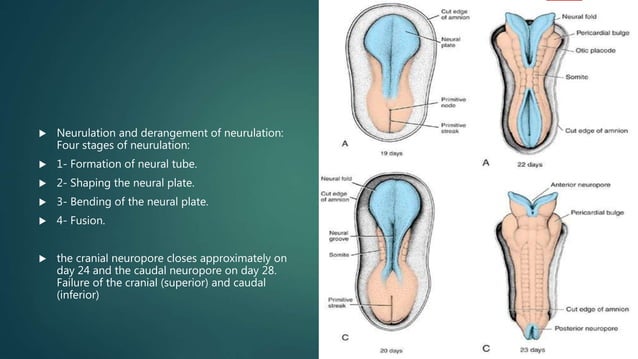 Spinal dysraphism | PPTX
