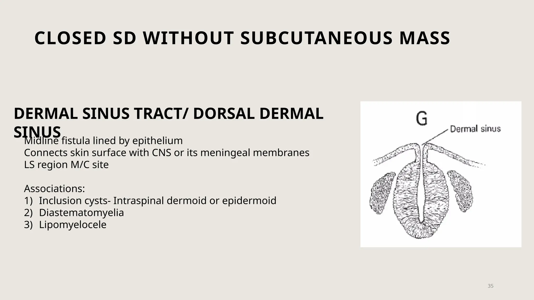 RADIOLOGICAL IMAGING IN CASES OF SPINAL DYSRAPHISM | PPTX