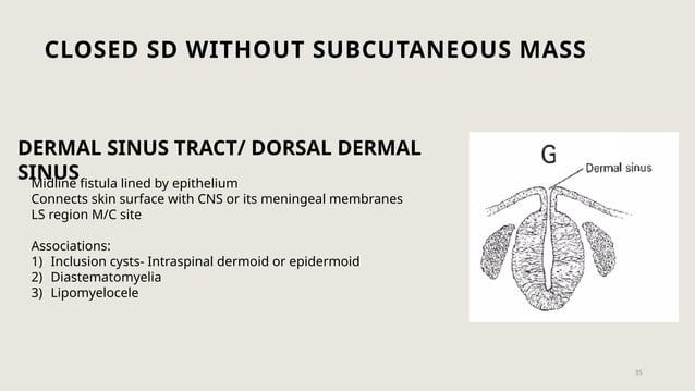 RADIOLOGICAL IMAGING IN CASES OF SPINAL DYSRAPHISM | PPT