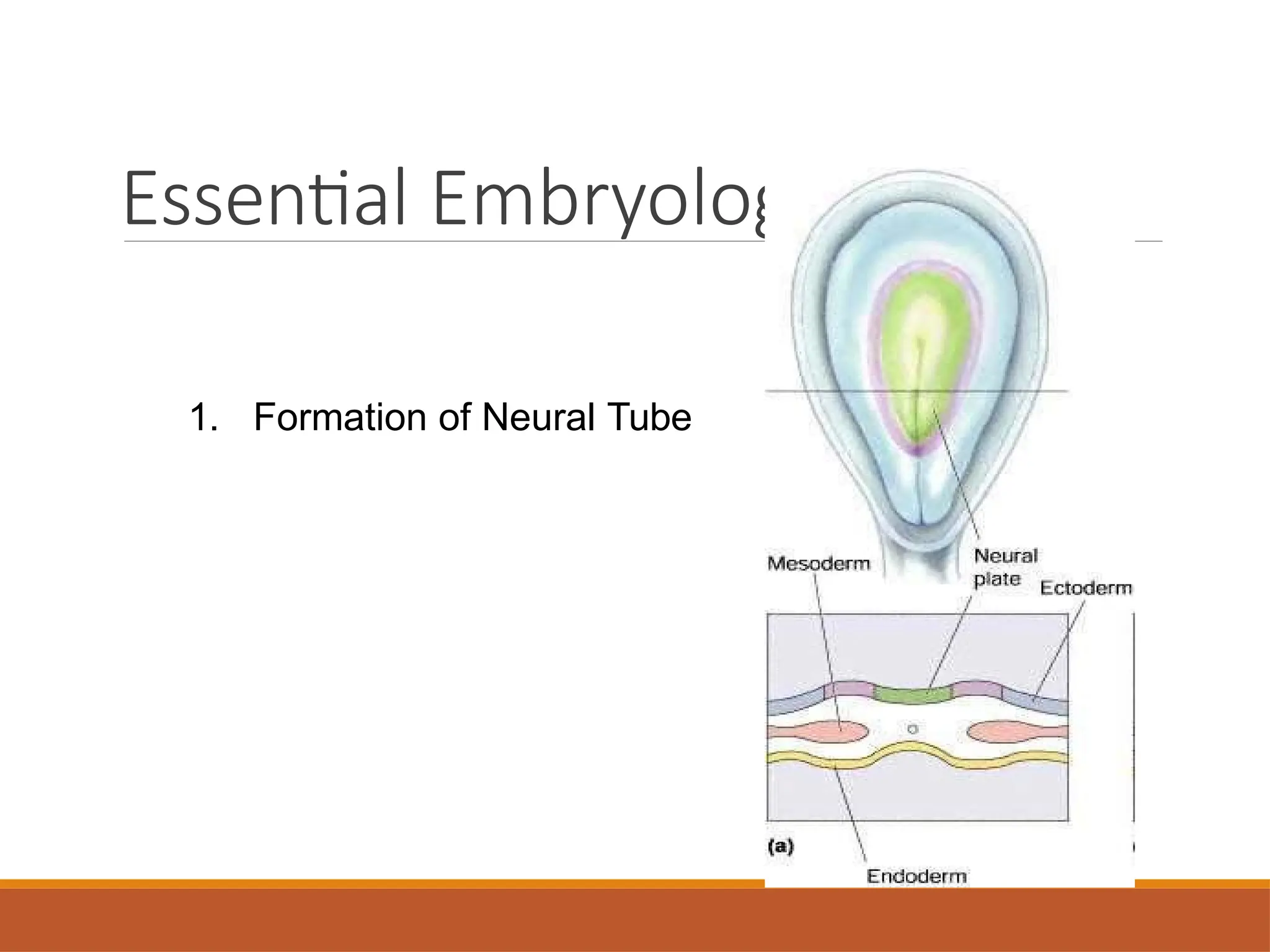 Spinal Dysraphism Embryology And Prsentation Pptx
