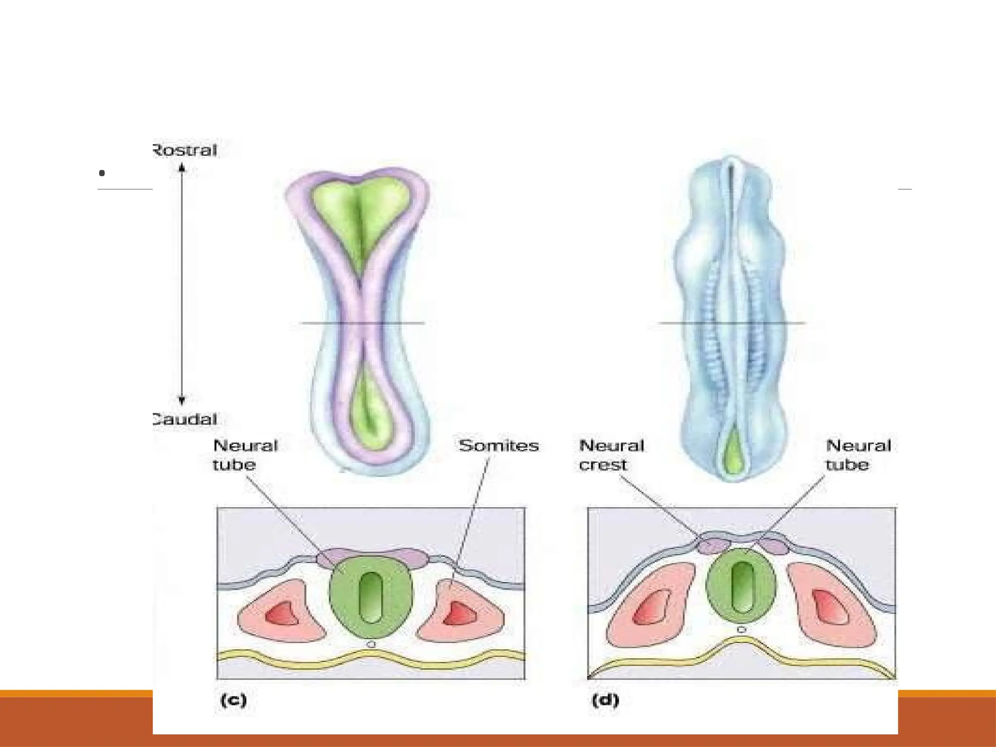Spinal Dysraphism Embryology And Prsentation Pptx