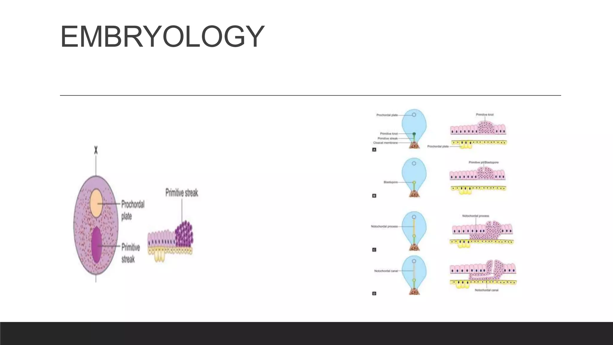 Spinal Dysraphism Vp Pptx