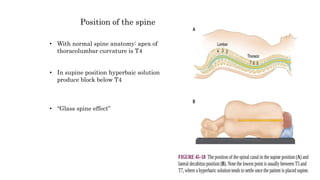 Caudal Anesthesia Technique