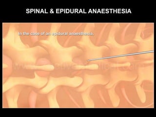 Spinal & epidural anaesthesia | PPT