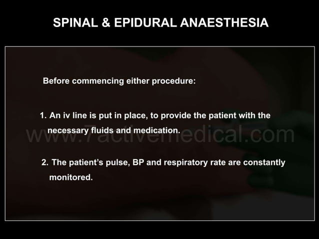 Spinal & epidural anaesthesia | PPTX