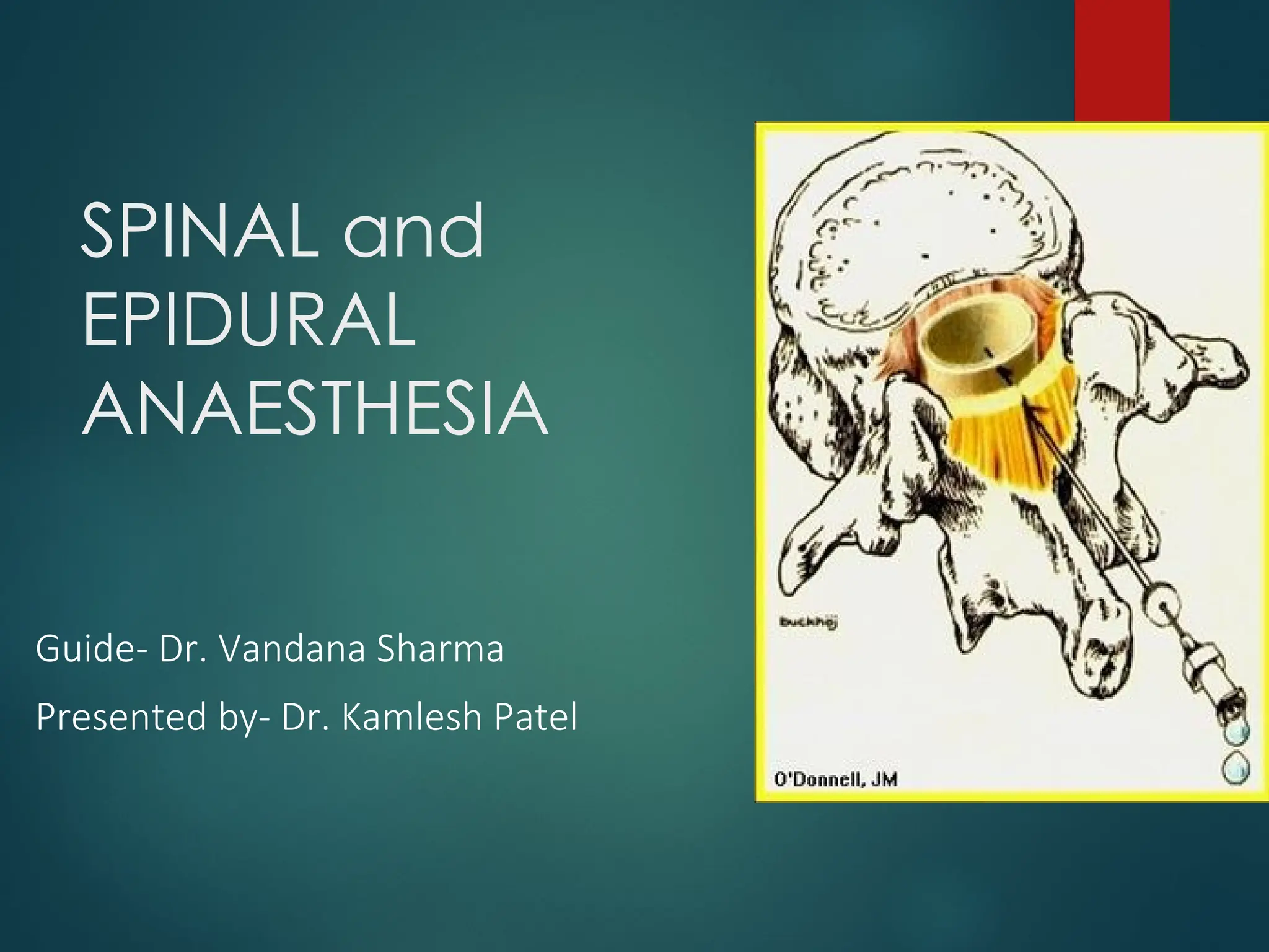 combined Spinal Epidural anaesthesia ppt | PPT